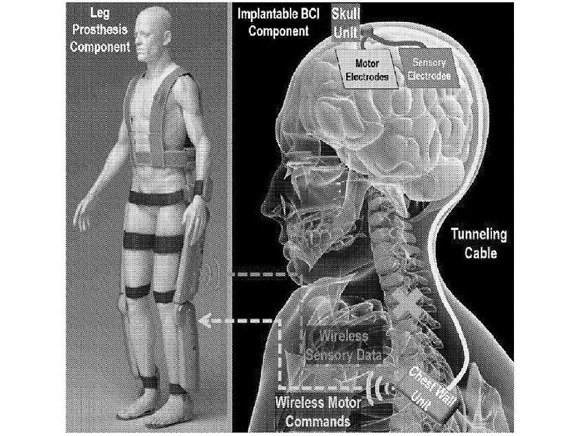 Researchers develop bidirectional brain-computer interface for ‘bionic suit’ | BioWorld